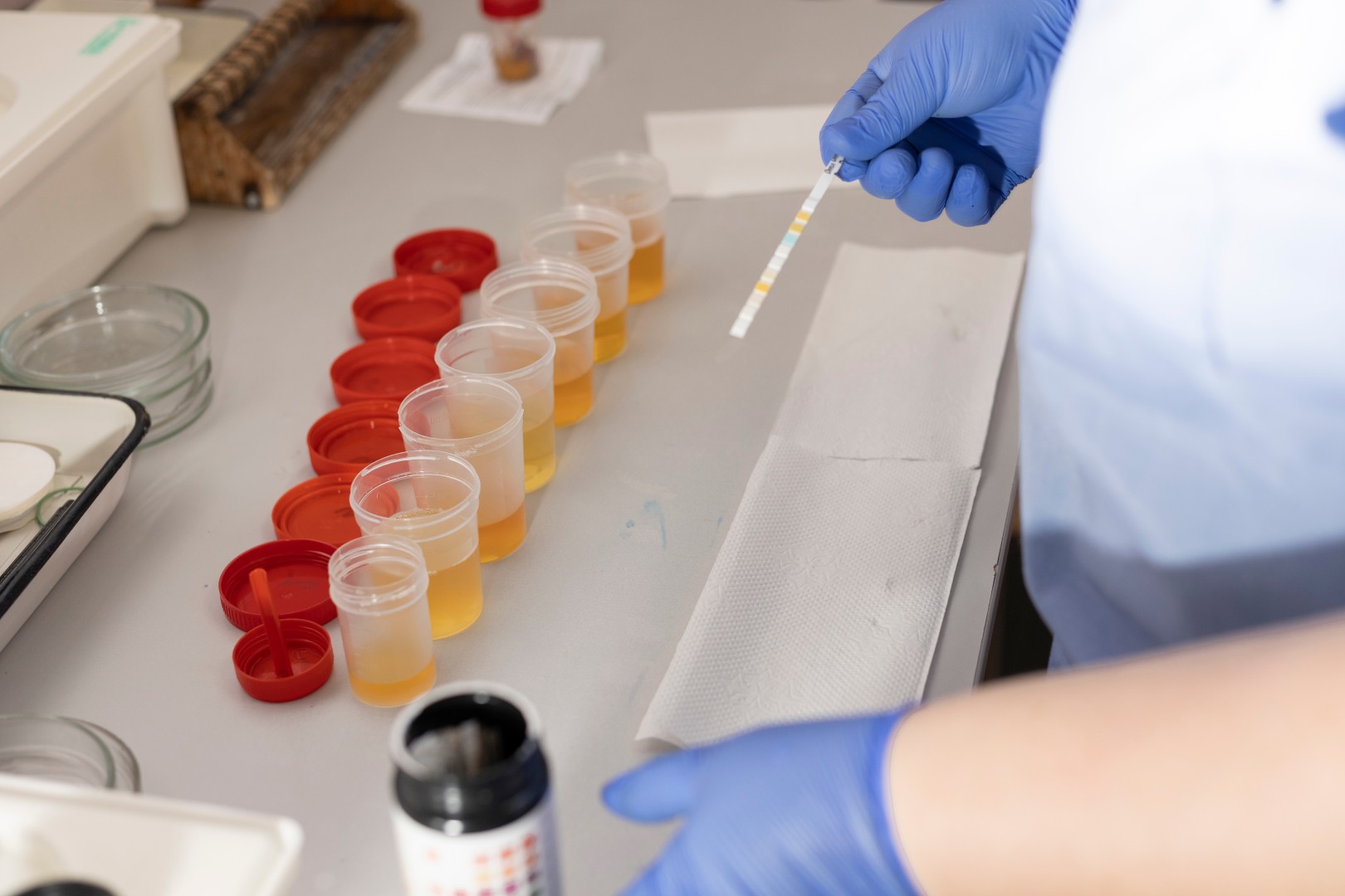 In-House Lab Testing in El Paso – Blood tests, Blood Sugar tests
